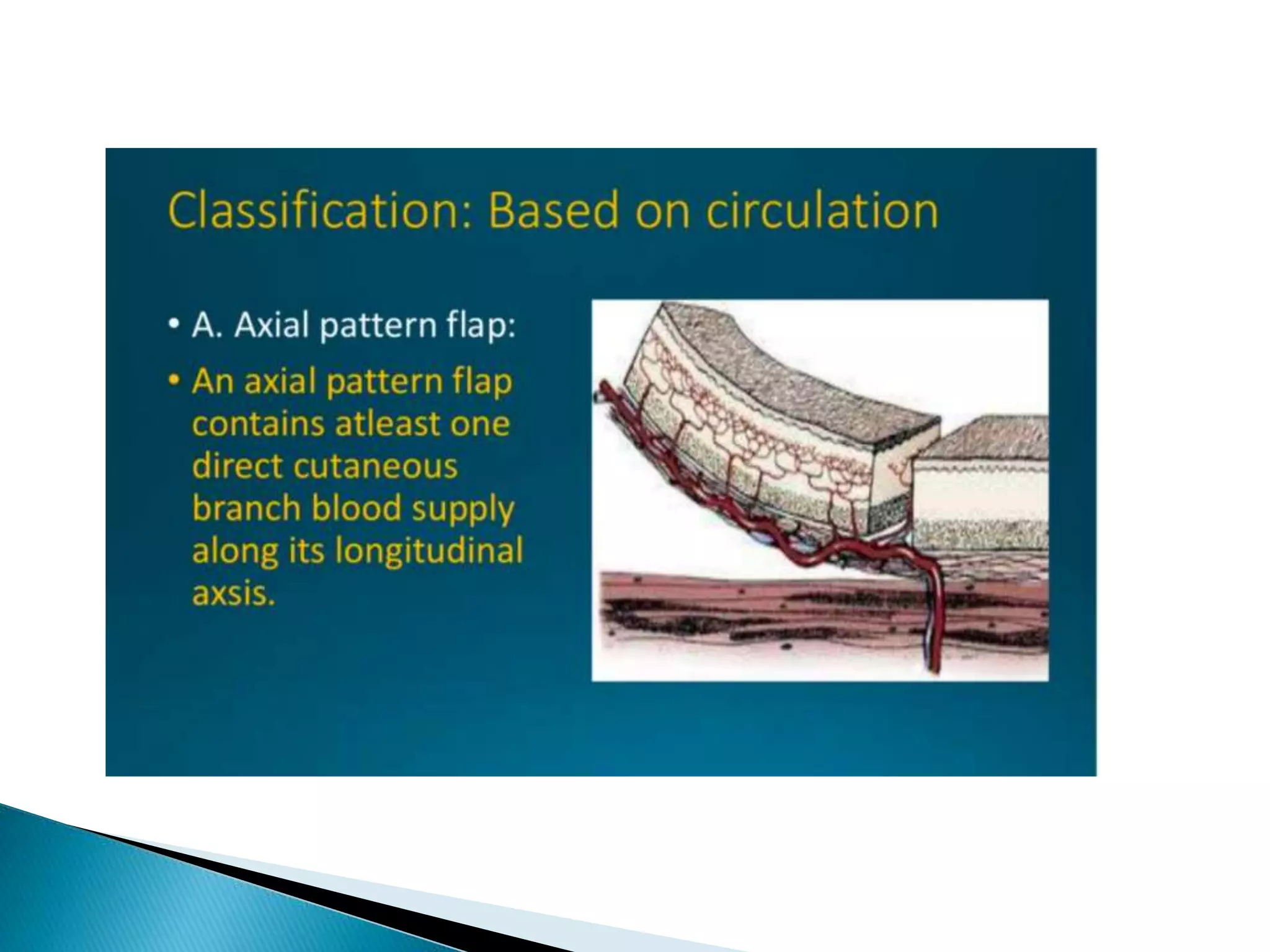 Flap and its classification | PPTX