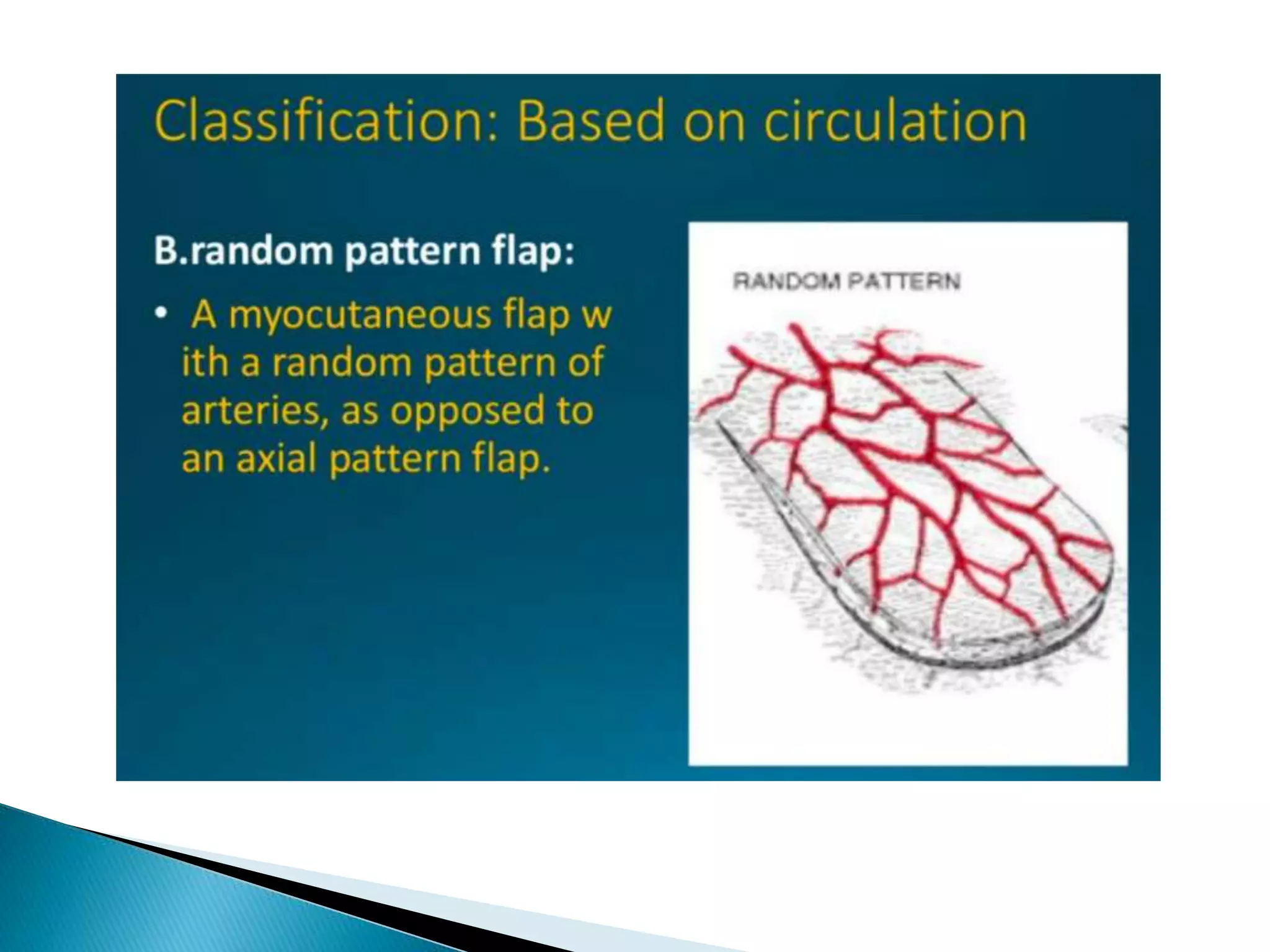 Flap and its classification | PPTX