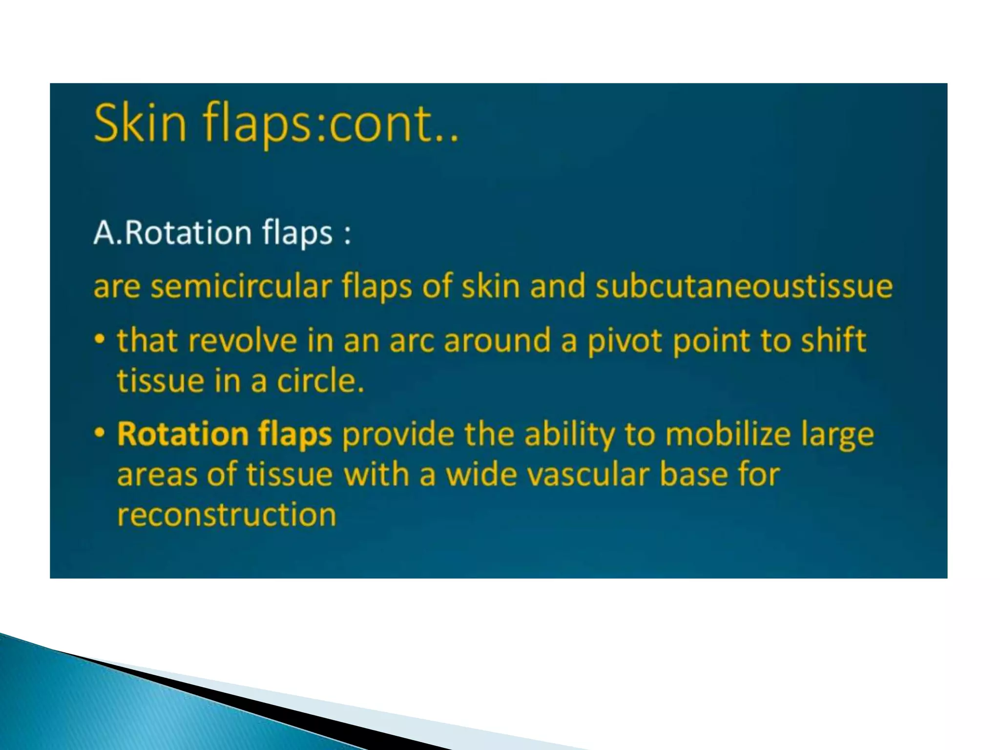 Flap and its classification | PPTX