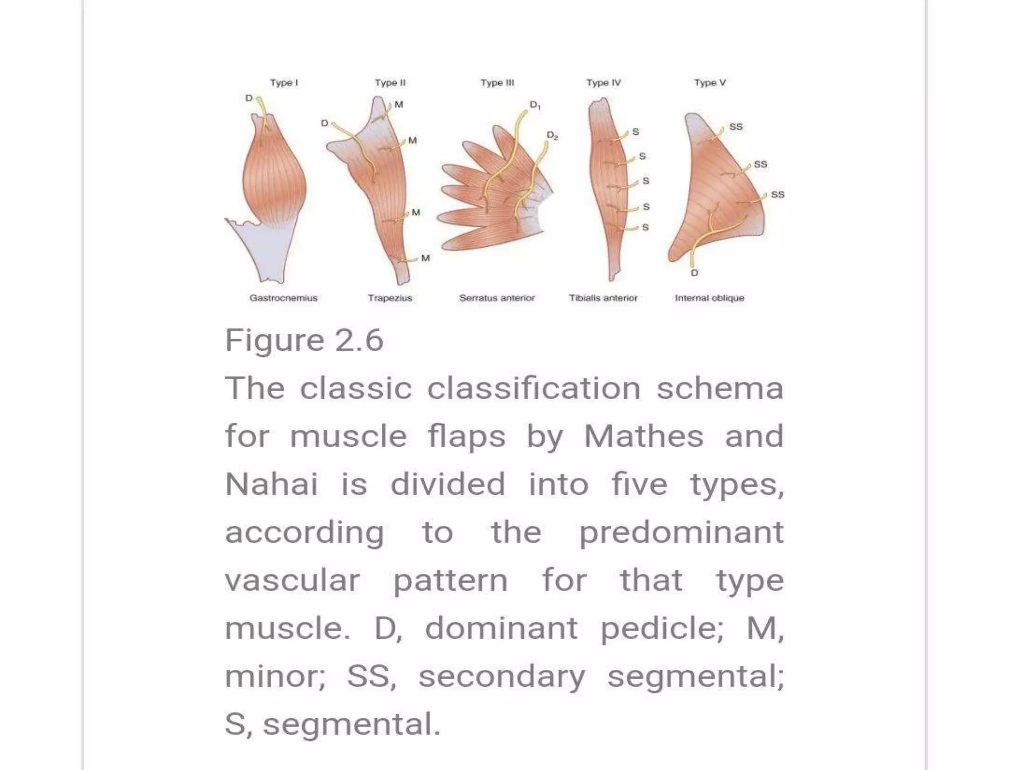 Flap and its classification | PPTX