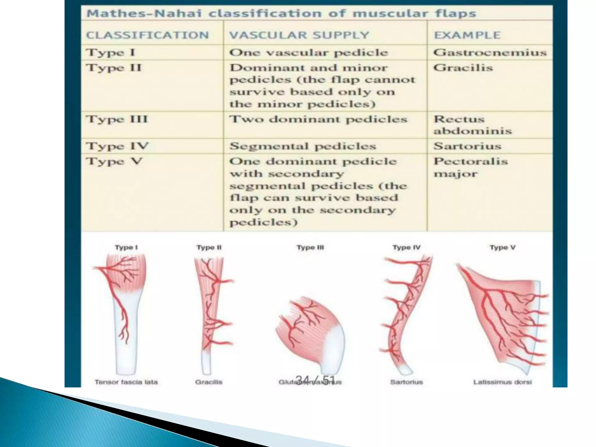 Flap and its classification | PPTX