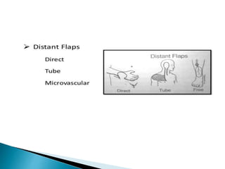 Flap and its classification | PPTX