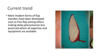 Flap delay.pptx | Blood Disorders | Diseases and Conditions