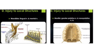 flap designs.pdf | Dental Health | Diseases and Conditions