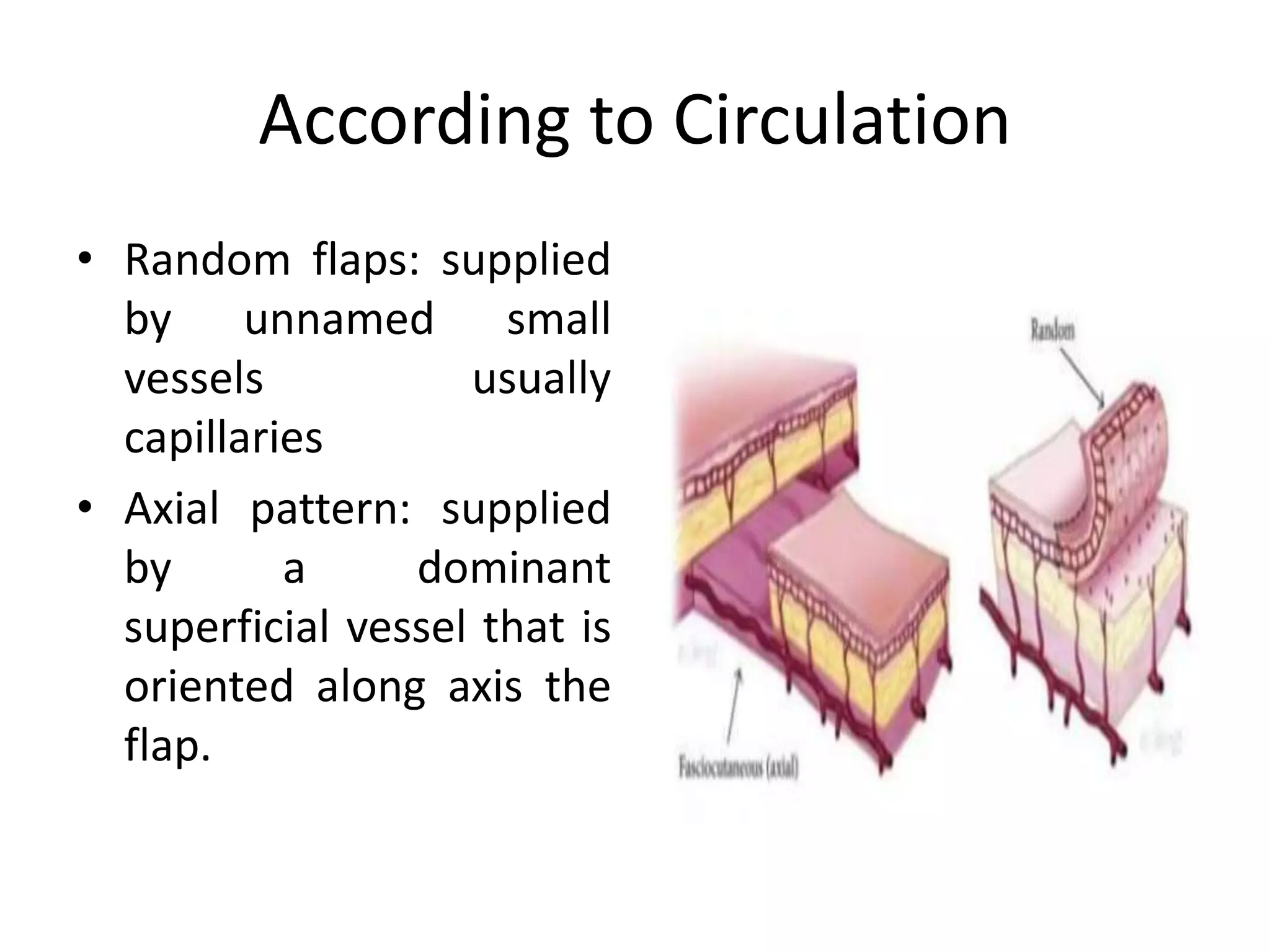 Flap in head and neck surgery part 1 | PPTX