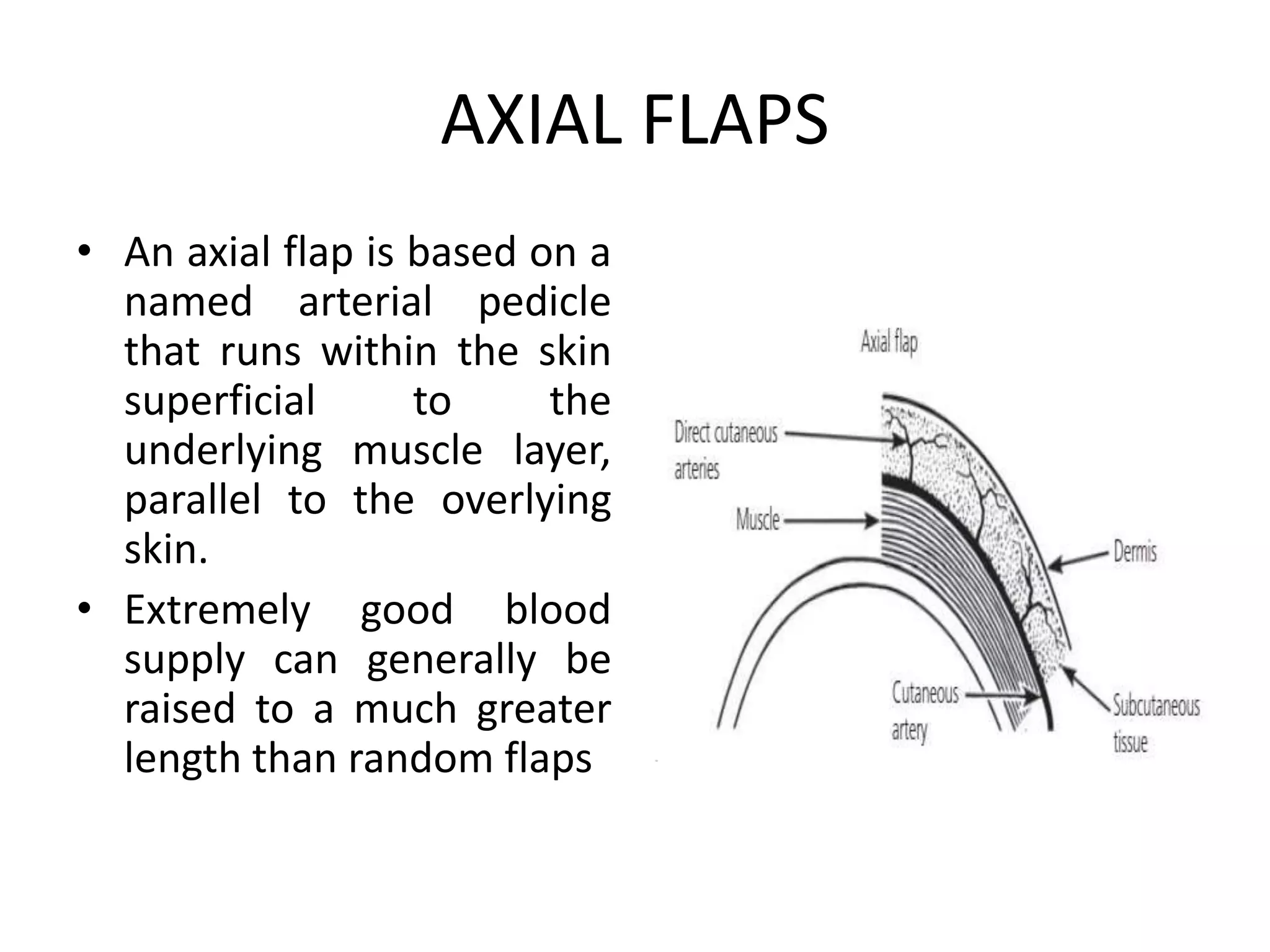 Flap in head and neck surgery part 1 | PPTX