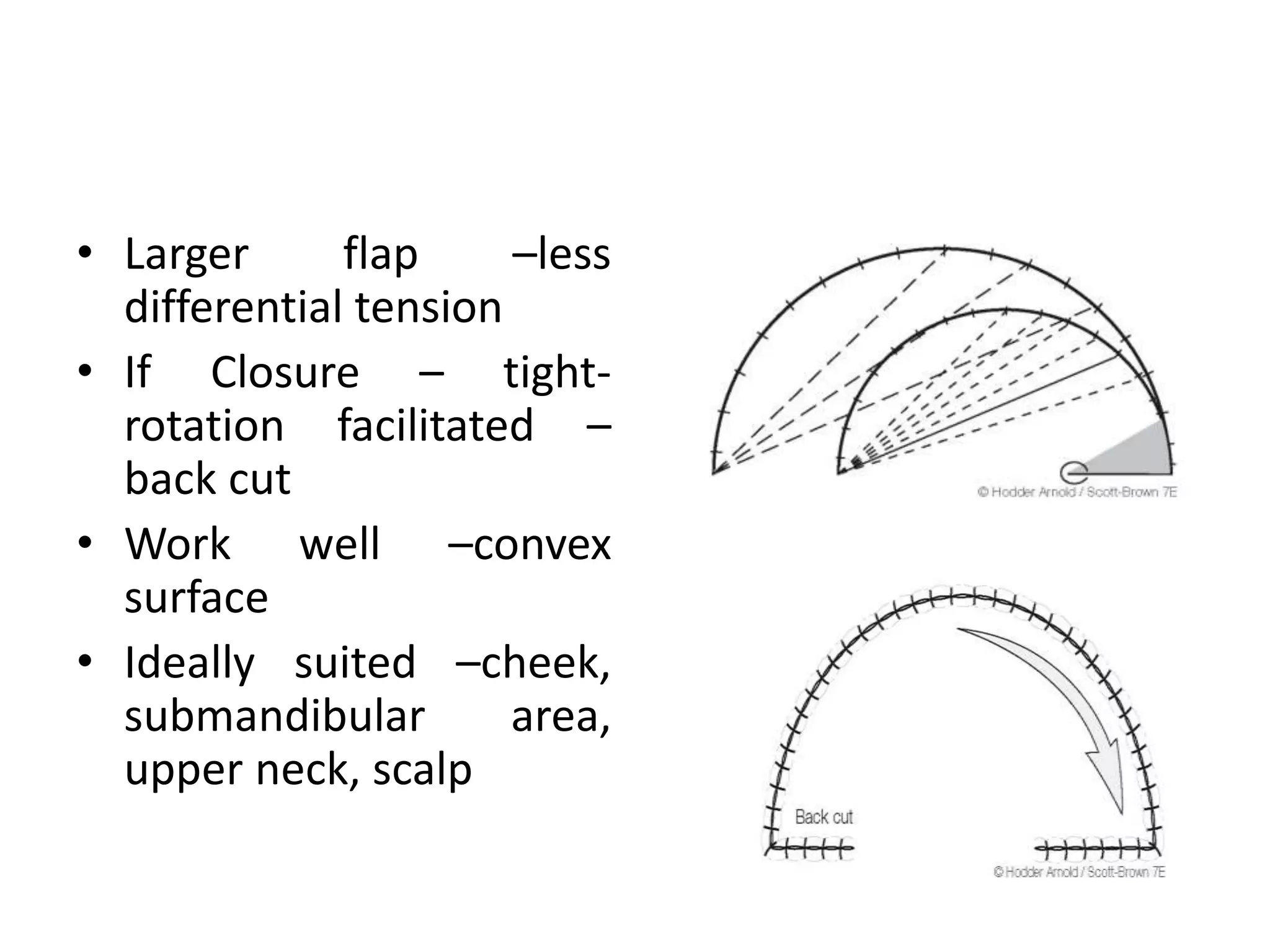 Flap in head and neck surgery part 1 | PPTX