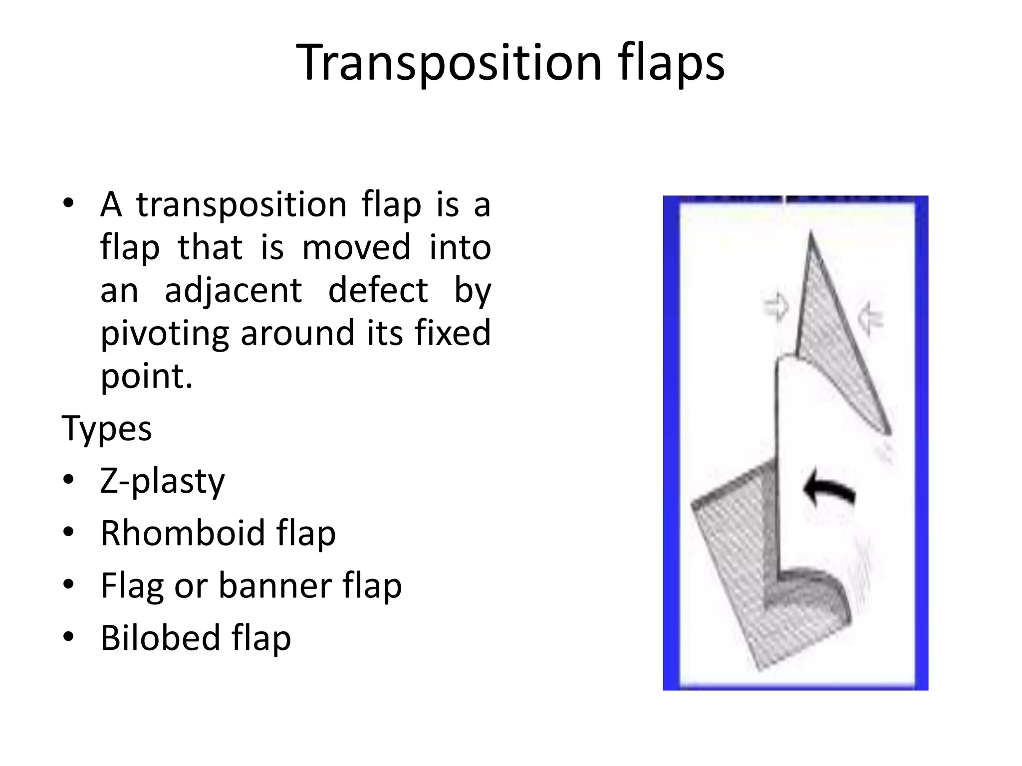 Flap in head and neck surgery part 1 | PPTX