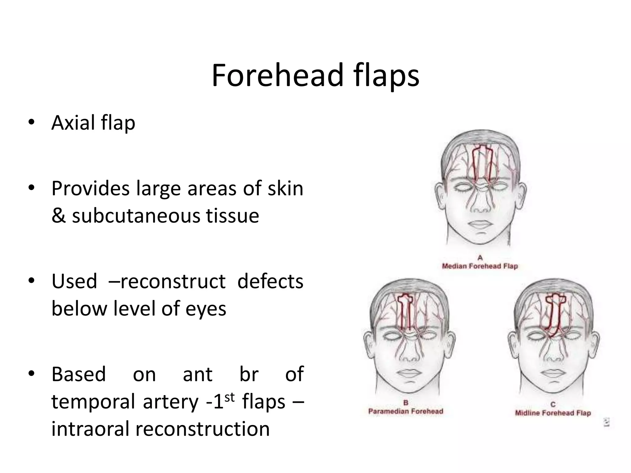 Flap in head and neck surgery part 1 | PPTX