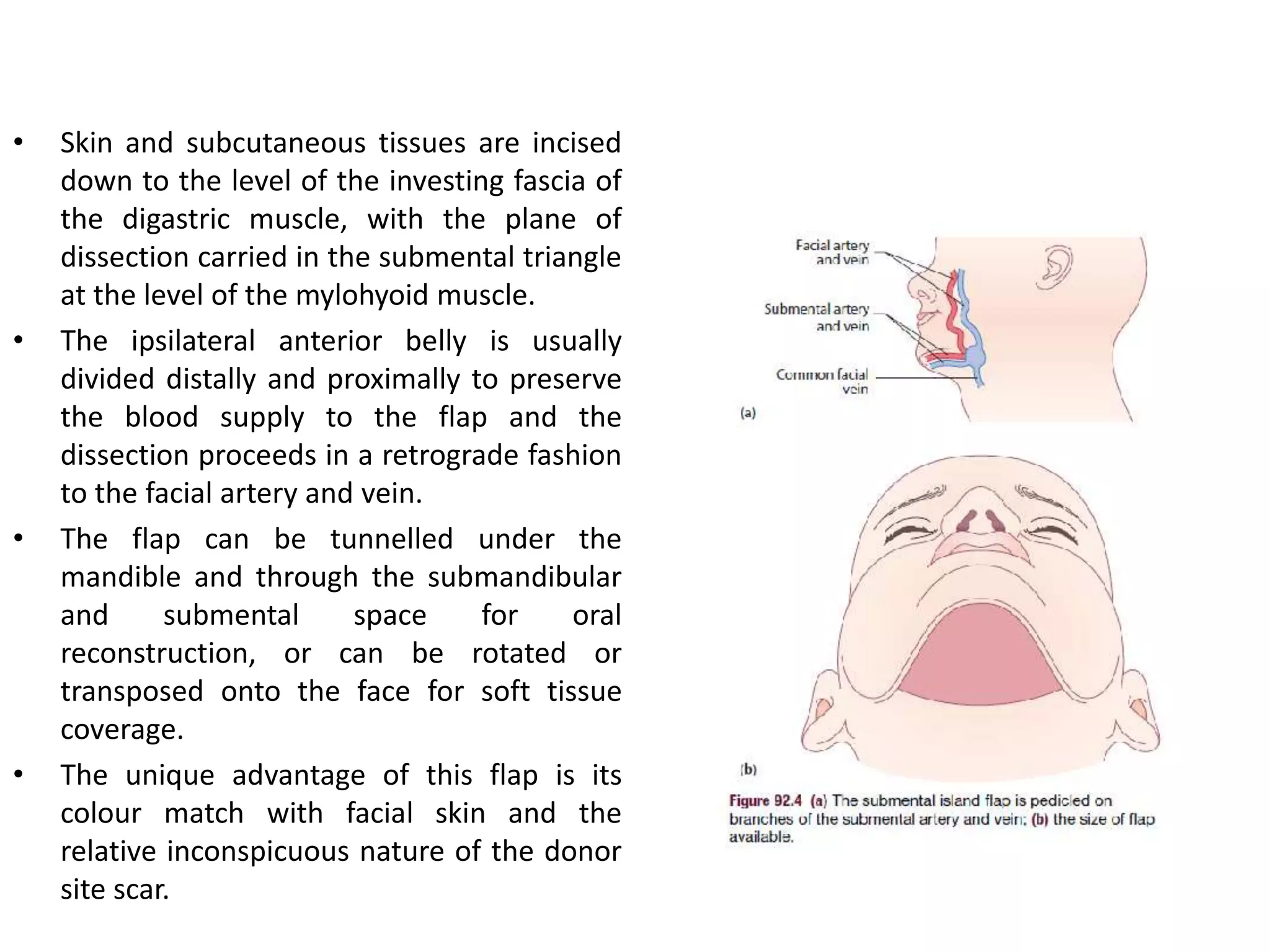 Flap in head and neck surgery part 1 | PPTX