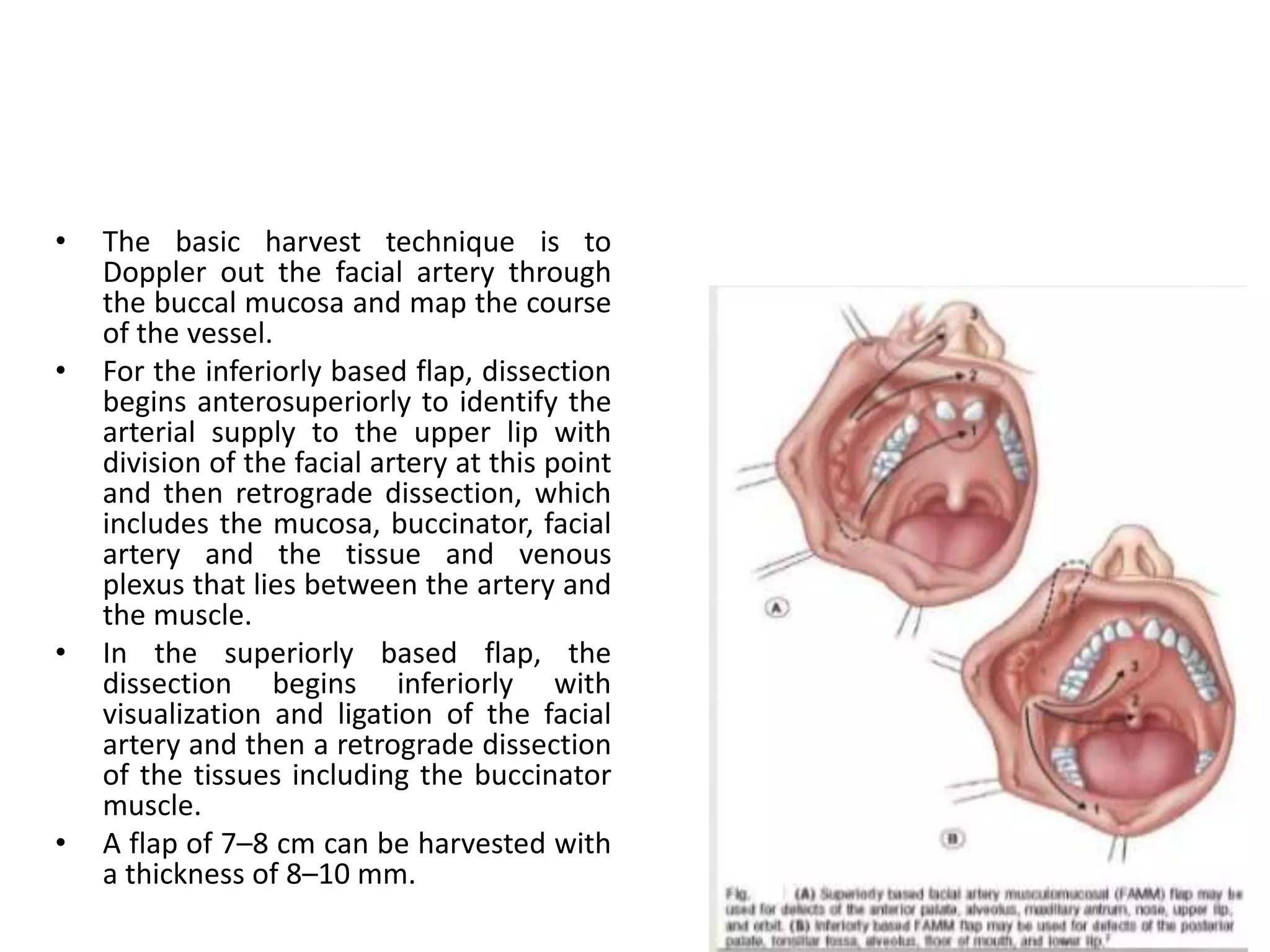 Flap in head and neck surgery part 1 | PPTX