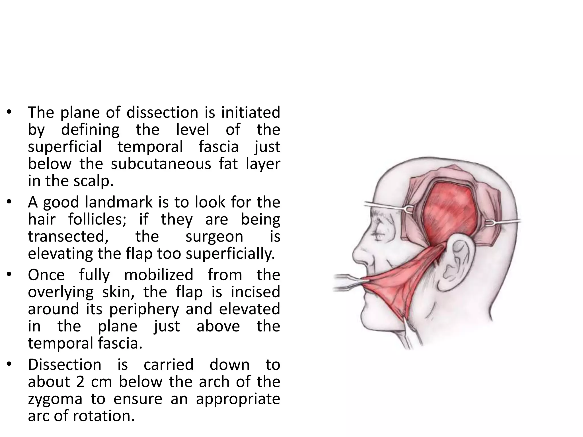 Flap in head and neck surgery part 1 | PPTX