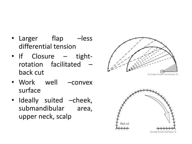Flap in head and neck surgery part 1 | PPTX