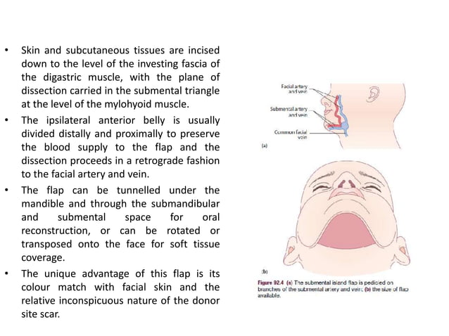 Flap in head and neck surgery part 1 | PPTX