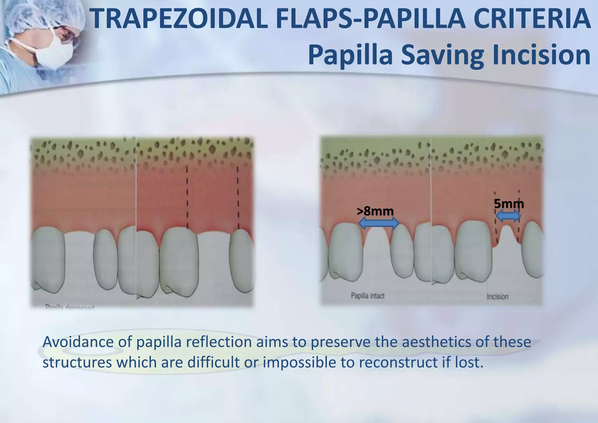Flap management improved | PPTX
