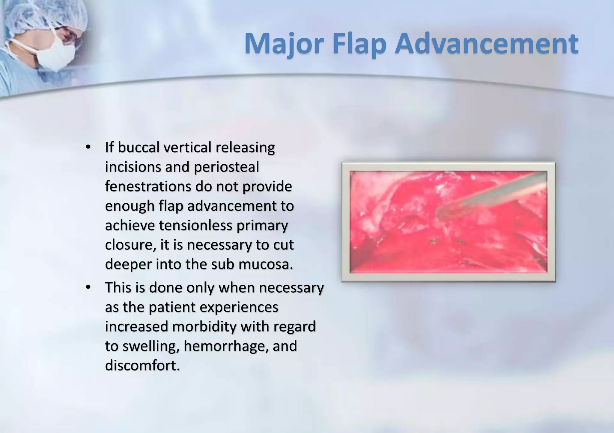 Flap management improved | PPTX