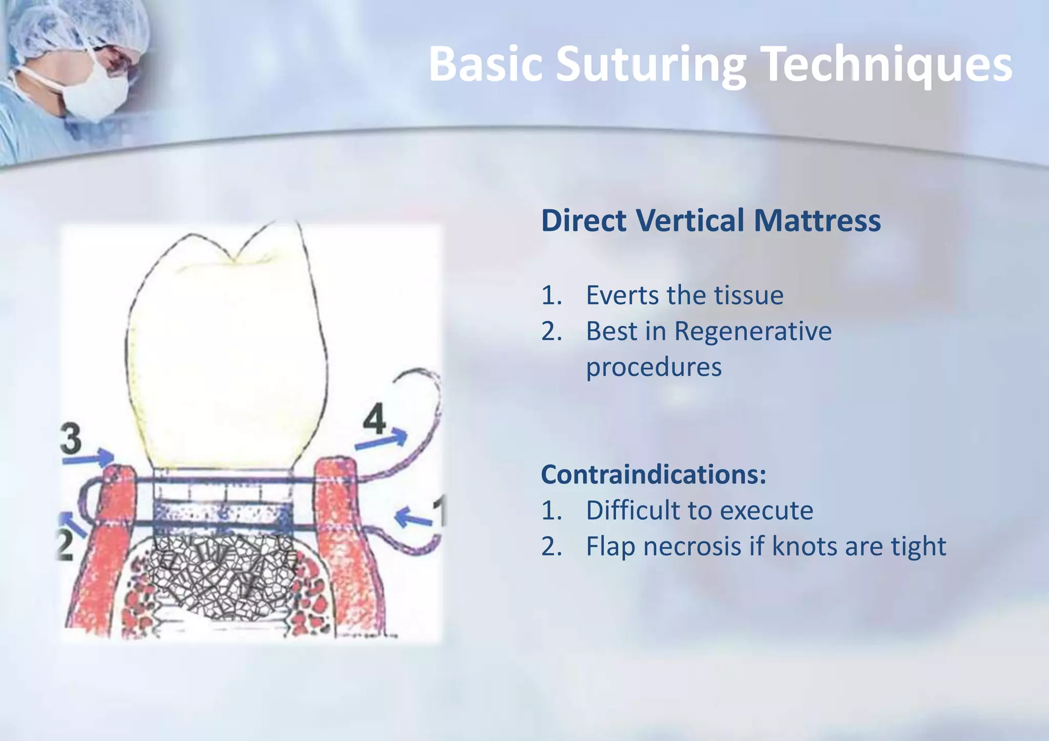 Flap management improved | PPTX