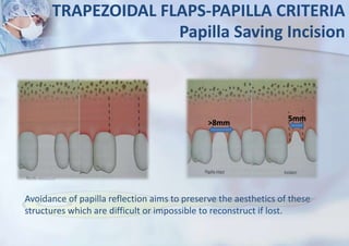 Flap management improved | PPTX