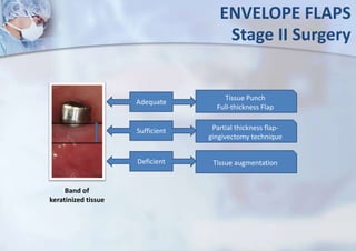 Flap management improved | PPTX