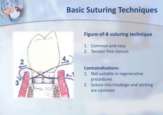 Flap management improved | PPTX