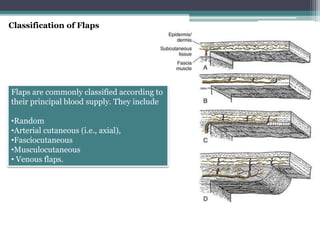 Flap physiology | PPT
