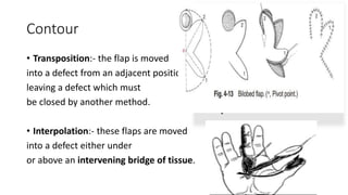 Flaps and grafts in plastic surgery | PPTX