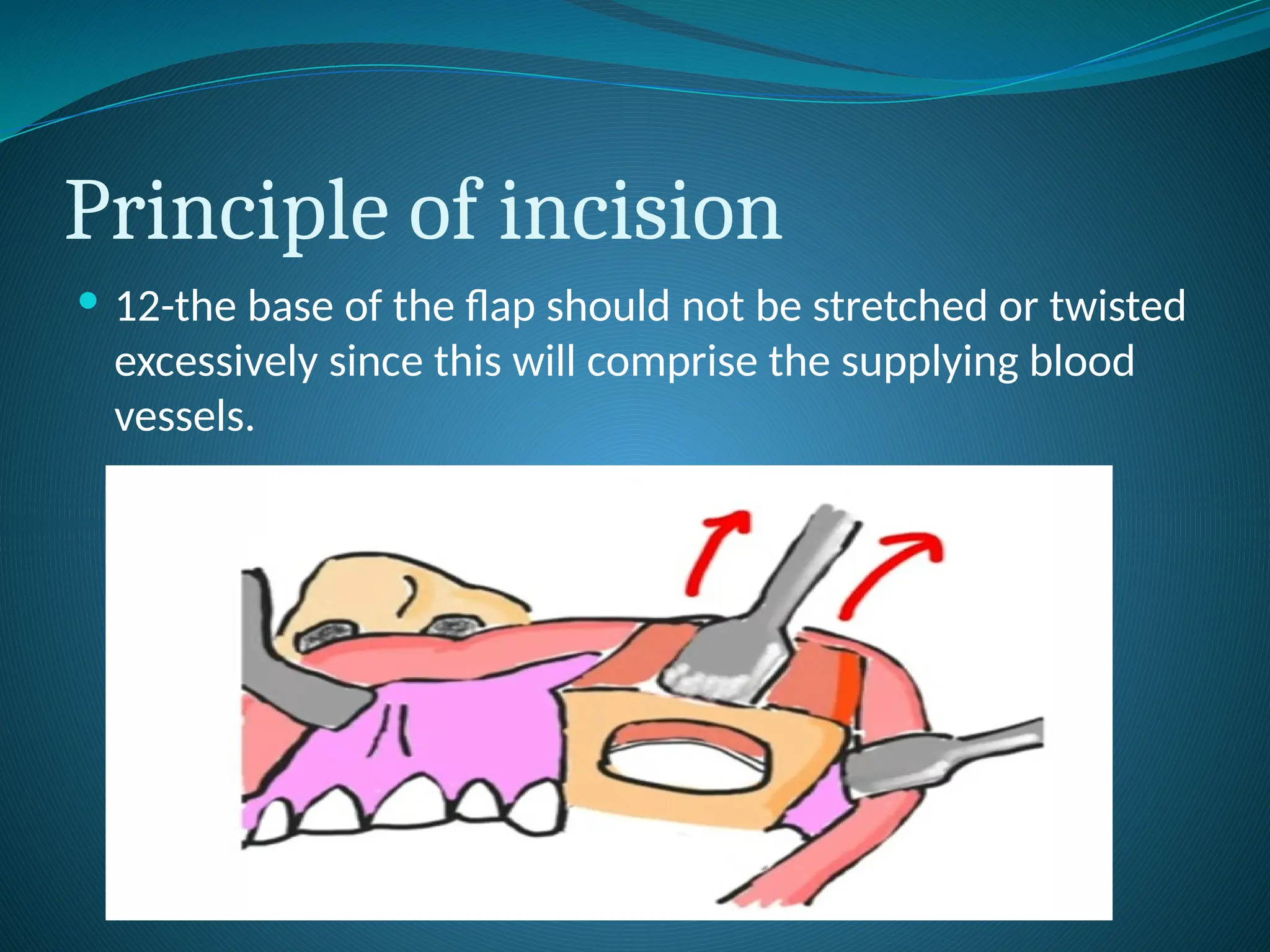 Incisions and intra oral flap design | PPTX