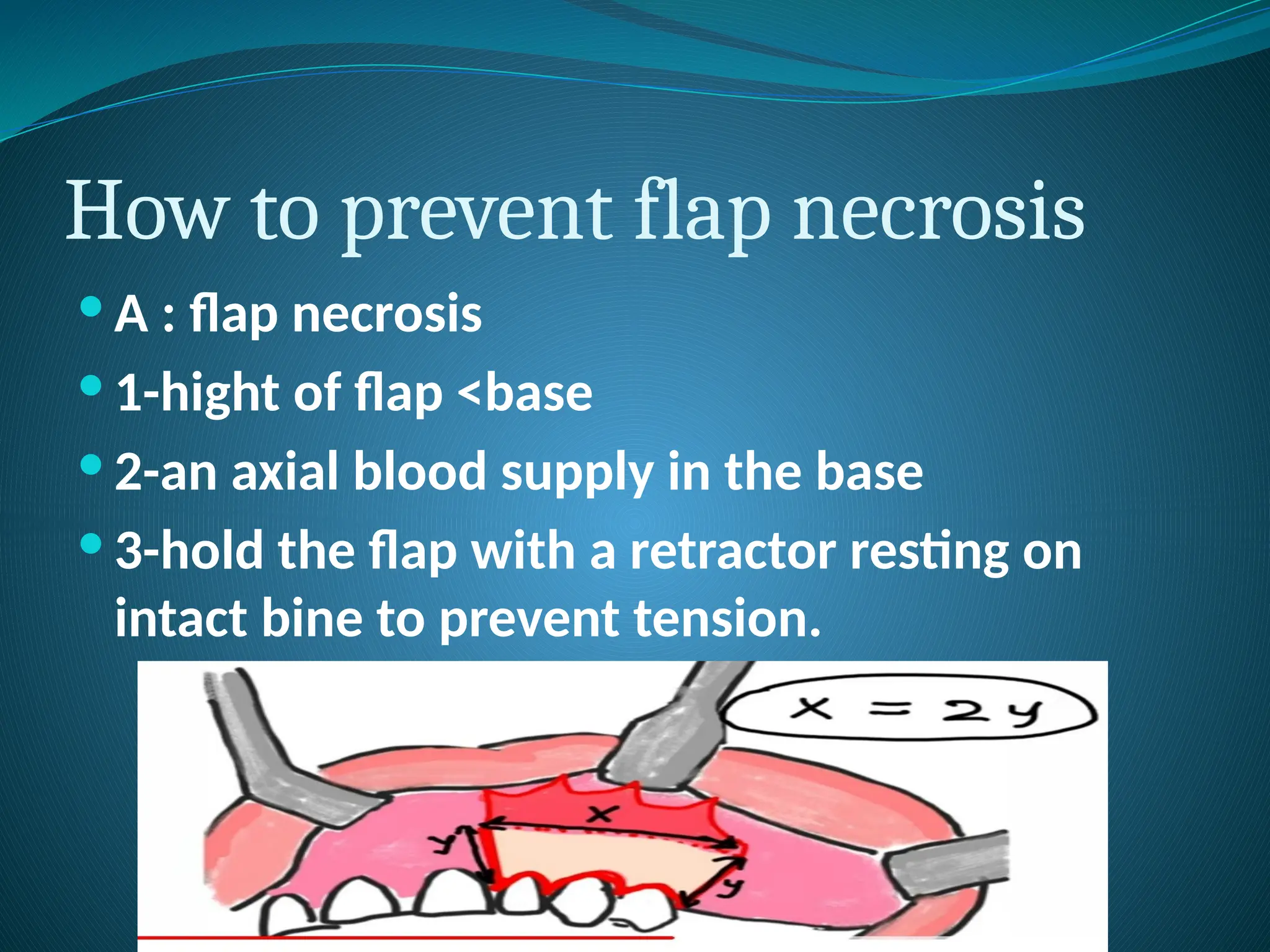 Incisions and intra oral flap design | PPTX
