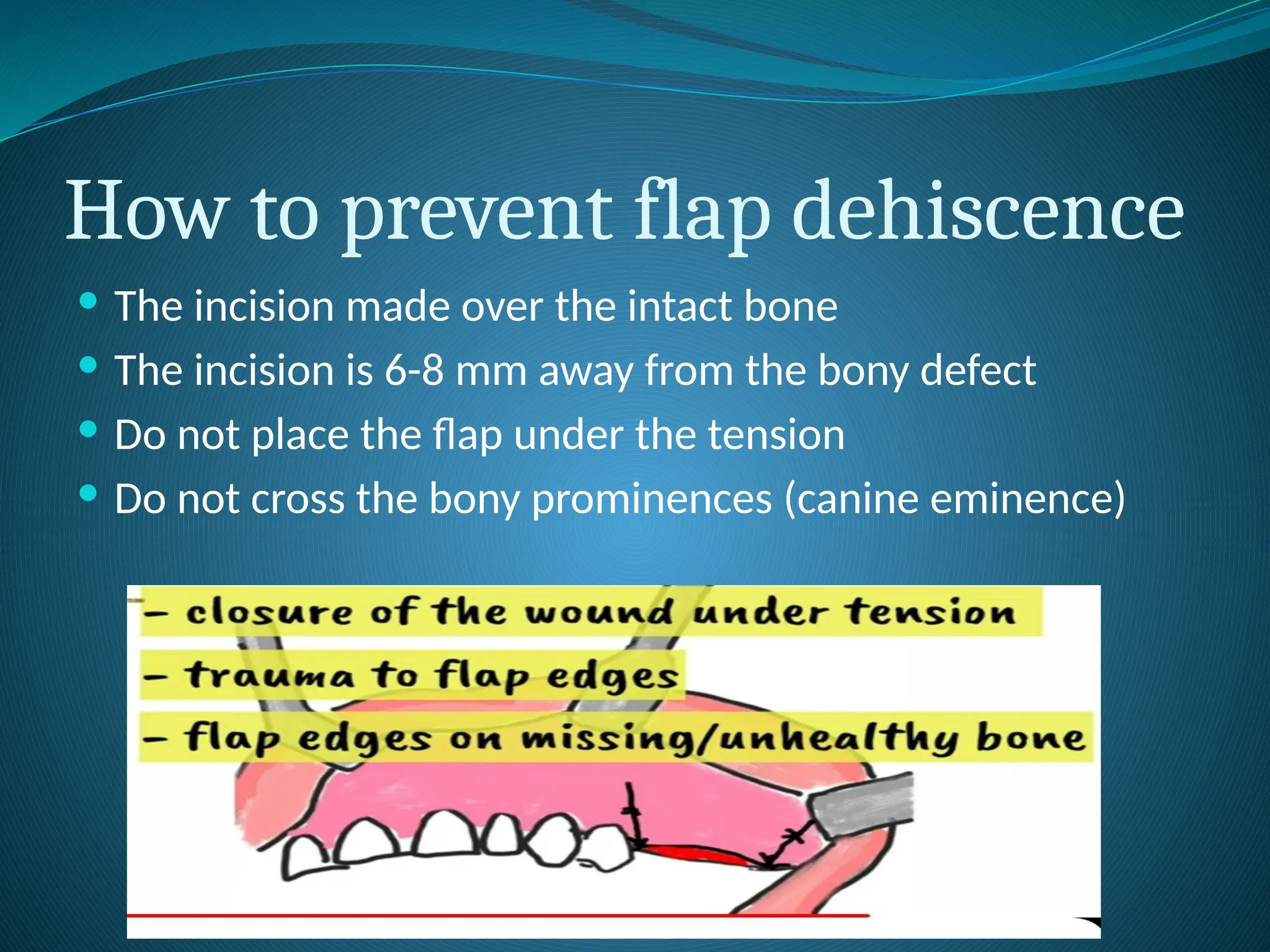 Incisions and intra oral flap design | PPTX