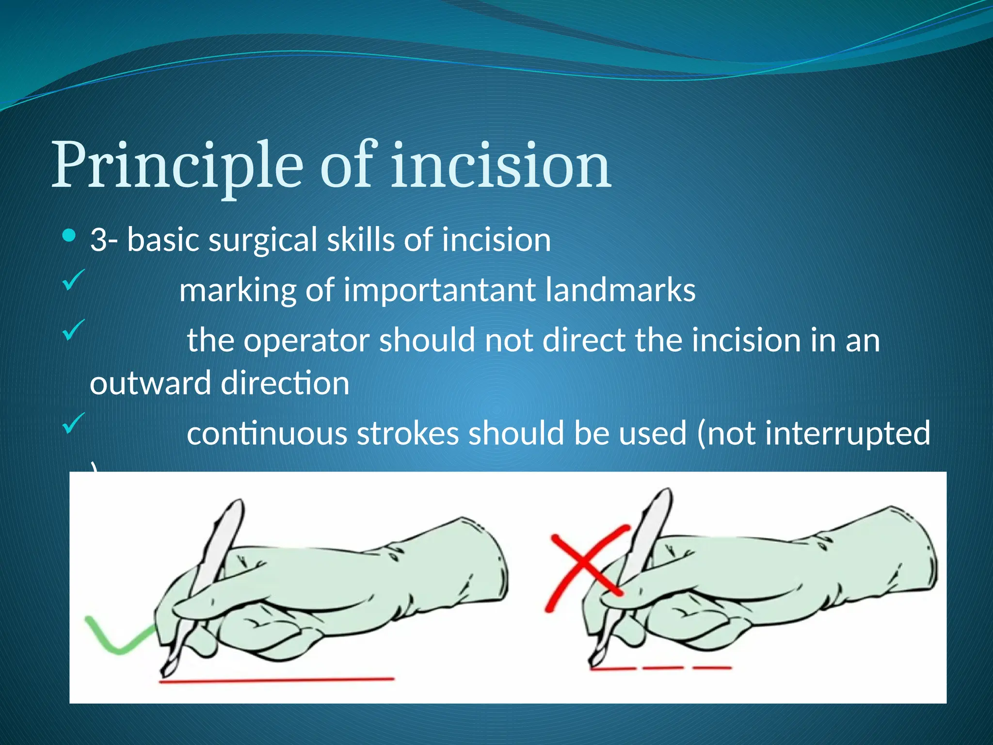 Incisions and intra oral flap design | PPTX