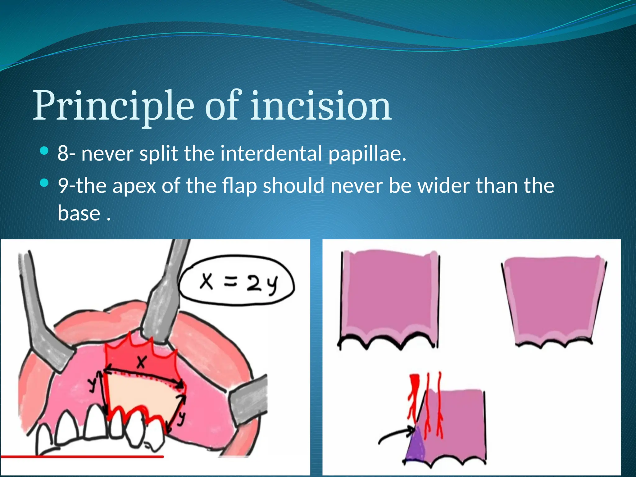 Incisions and intra oral flap design | PPTX