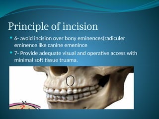 Incisions and intra oral flap design | PPTX
