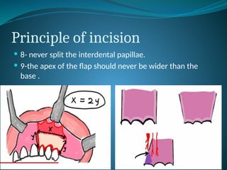 Incisions and intra oral flap design | PPTX