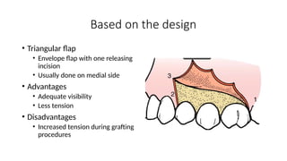 Comprehensive Guide to Soft-Tissue Flap Techniques for Implant ...