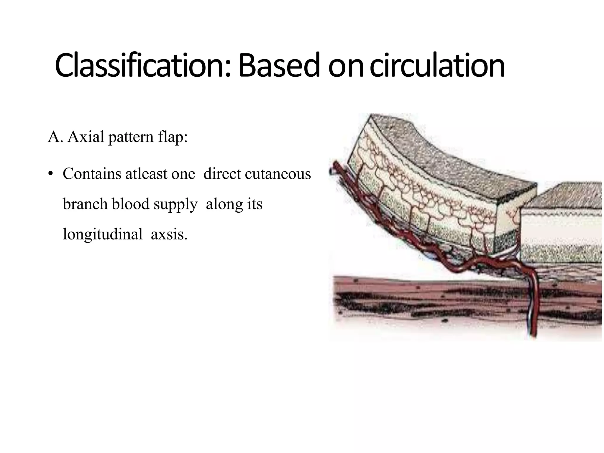 Flaps and its classification | PPTX