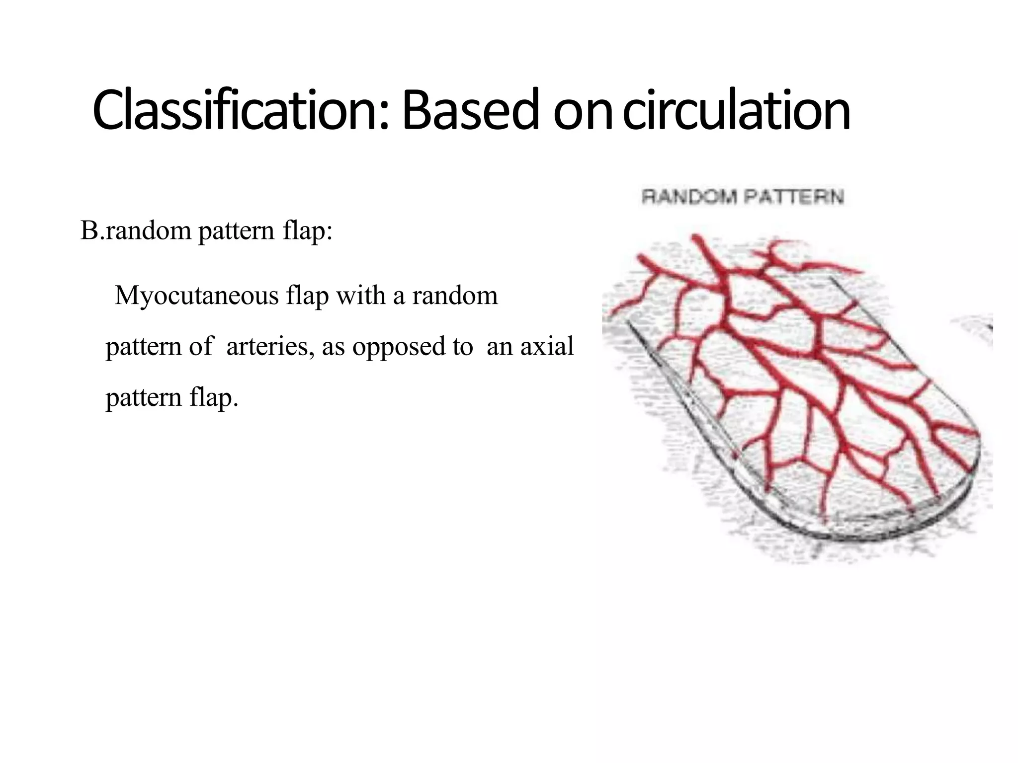 Flaps and its classification | PPTX