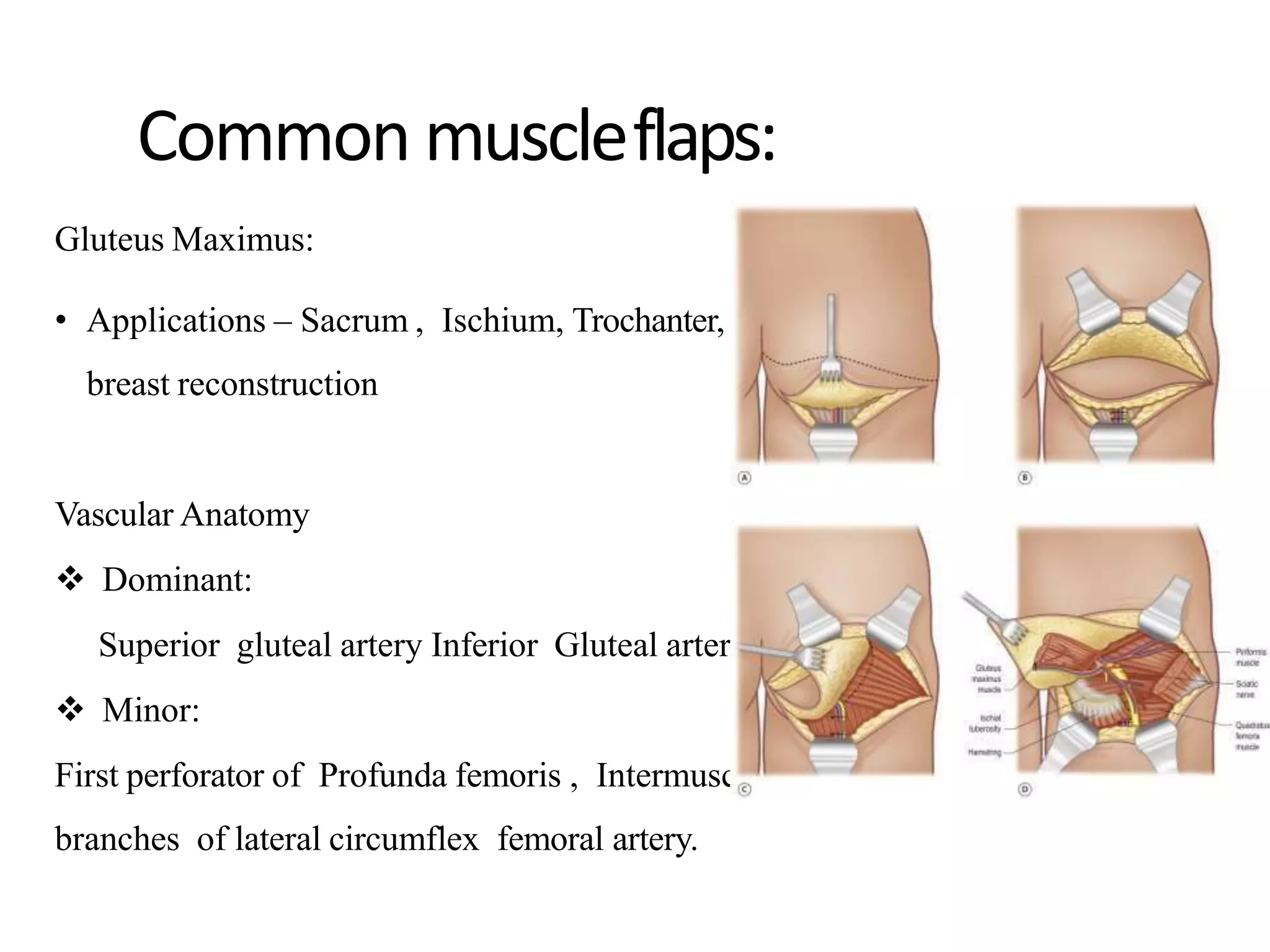 Flaps and its classification | PPTX