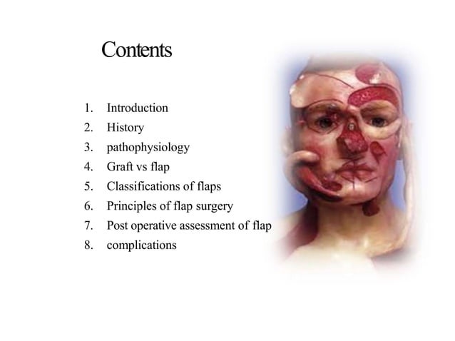 Flaps and its classification | PPTX