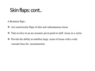 Flaps and its classification | PPTX