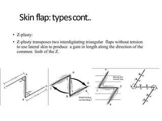 Flaps and its classification | PPTX