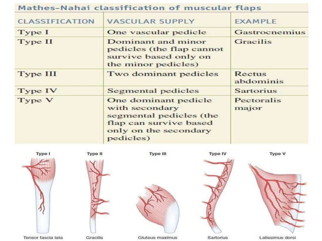 Flaps and its classification | PPTX