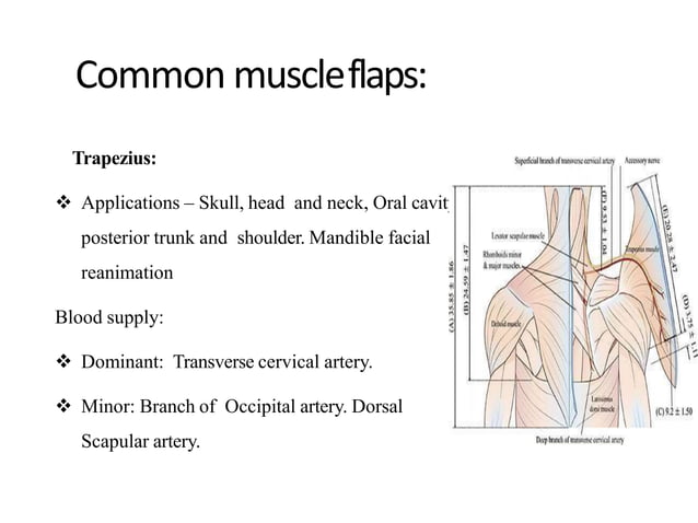 Flaps and its classification | PPTX