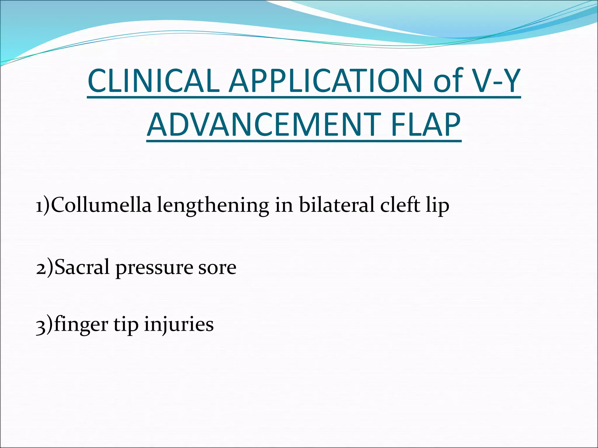 Flaps Basics and Important Leg Flaps and Trauma to Leg management | PPT
