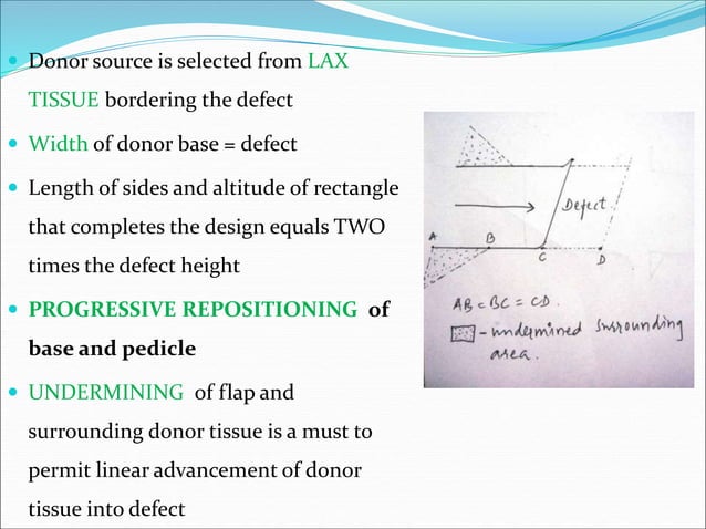 Flaps Basics and Important Leg Flaps and Trauma to Leg management | PPT