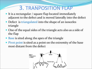 Flaps Basics and Important Leg Flaps and Trauma to Leg management | PPT