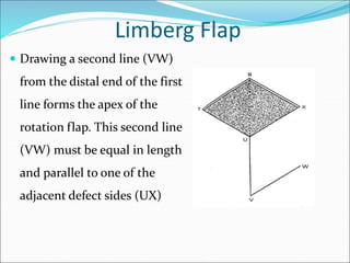 Flaps Basics and Important Leg Flaps and Trauma to Leg management | PPT
