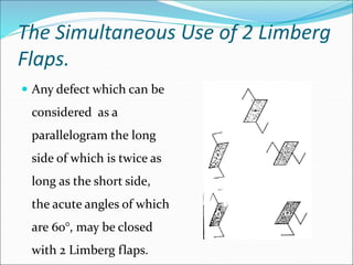 Flaps Basics and Important Leg Flaps and Trauma to Leg management | PPT
