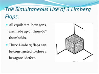 Flaps Basics and Important Leg Flaps and Trauma to Leg management | PPT