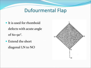 Flaps Basics and Important Leg Flaps and Trauma to Leg management | PPT
