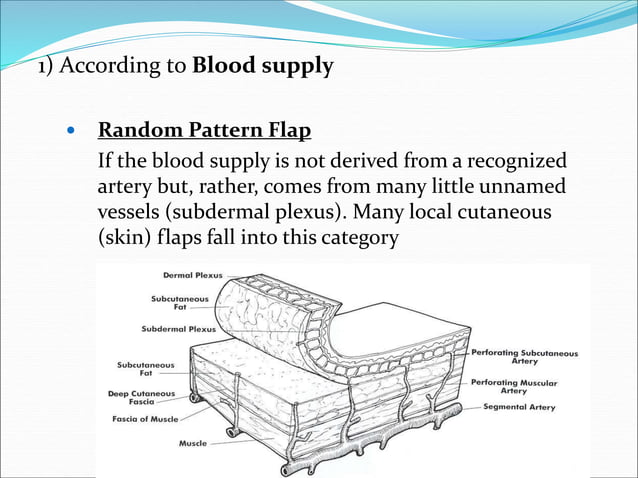 Flaps Basics and Important Leg Flaps and Trauma to Leg management | PPT